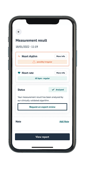 How can you ask for a review?